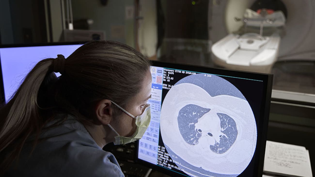 A Bold Approach to Early Lung Cancer Detection–and Action - Temple Health