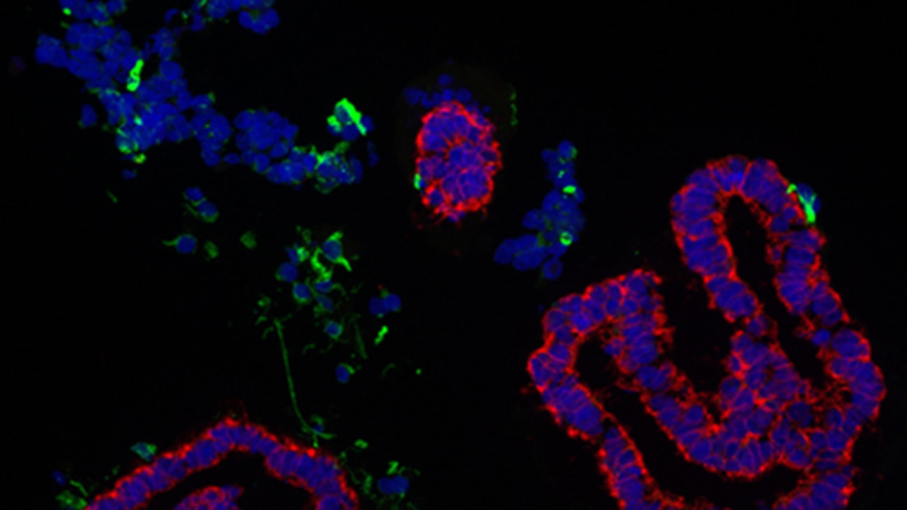 Scientists Develop Model for IBD Fibrosis Using Stem Cells - Cedars ...