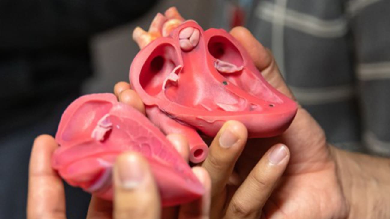 3D Cardiovascular Simulation Lab Revolutionizes Heart Surgery - Tampa ...
