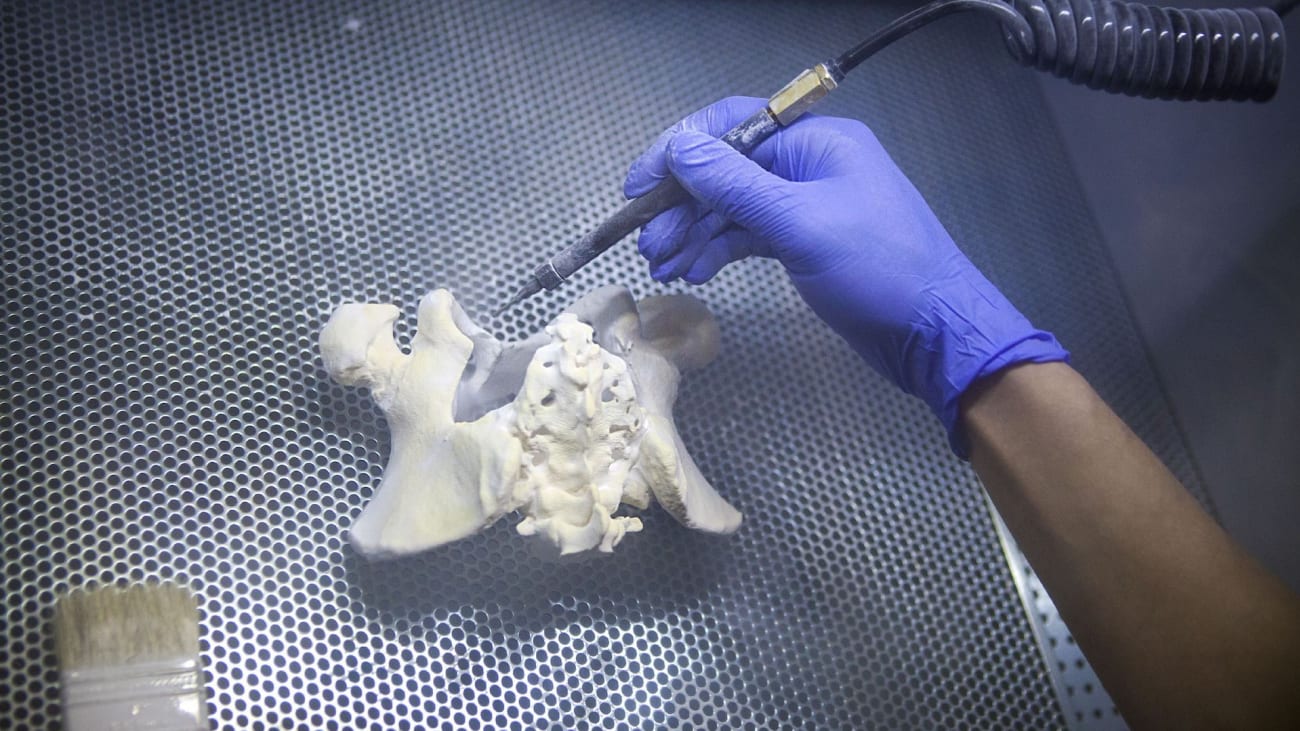How 3D-Printed, Patient-Specific Models Reduce Orthopaedic Surgery Time ...