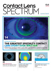 Putting a Bitoric Fitting Guide to the Test | Contact Lens Spectrum