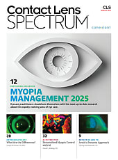 Putting a Bitoric Fitting Guide to the Test | Contact Lens Spectrum