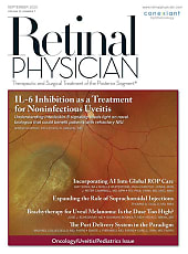 Scleral Fixation of Intraocular Lenses | New Retinal Physician