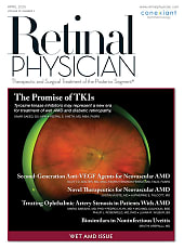 Surgical Management of a Dropped Lens as a Complication of Cataract ...