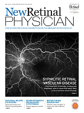 Peer-Reviewed: Pattern Dystrophy of the Retinal Pigment Epithelium ...