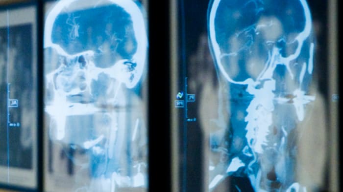 Memory and Brain Wellness Center - BroadcastMed