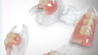 RPD Step by Step with Flexible CAD Partials | Inside Dental Technology