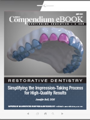 Simplifying the Impression-Taking Process for High-Quality Results ...