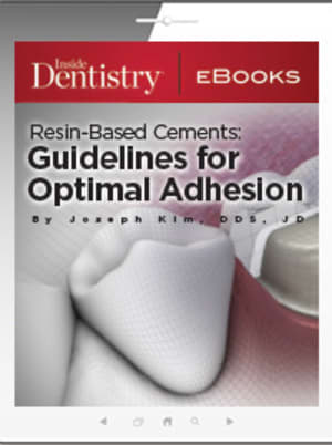 Resin-Based Cements: Guidelines for Optimal Adhesion | Inside Dentistry