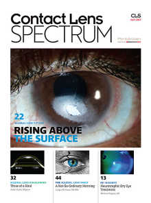 July | Contact Lens Spectrum