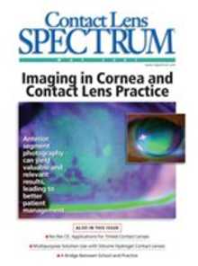 May | Contact Lens Spectrum