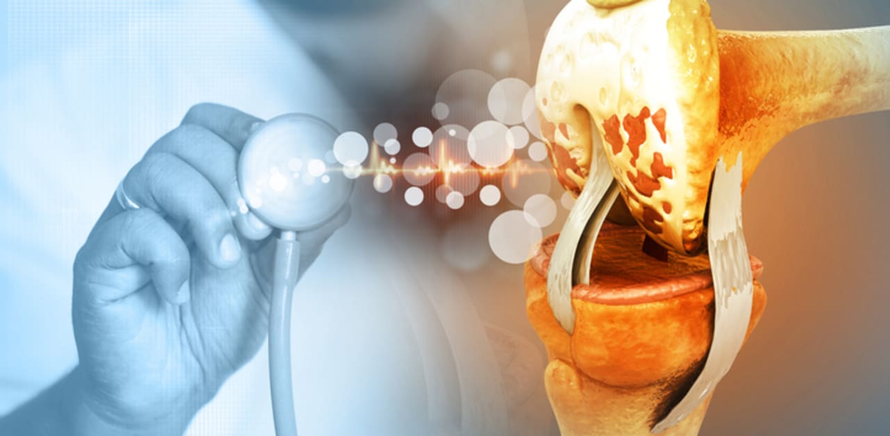 Sex Differences in Patellar Facet Shape Identified in Healthy and ...