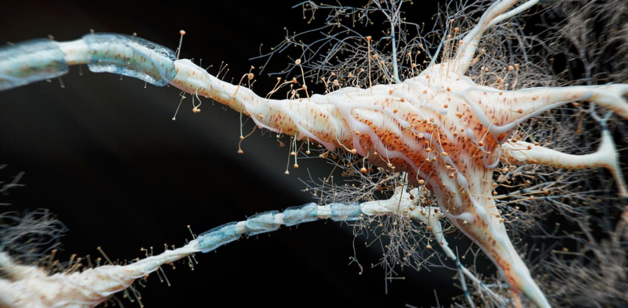 Long-Term Tofersen Shows Benefit in SOD1-Mutated ALS | Conexiant