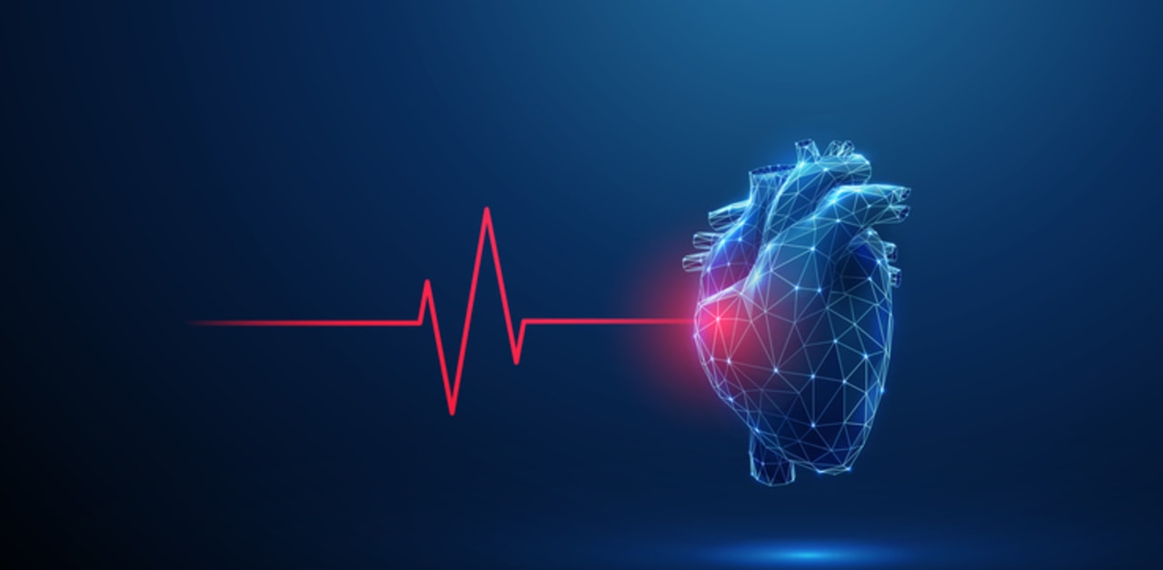 Cardiogenic Shock in Women: Treatment Disparities Persist | Conexiant