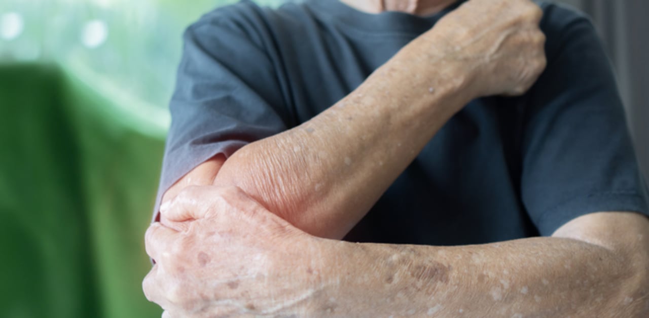 Experts Set First Global CNO Treatment Guidelines | Conexiant