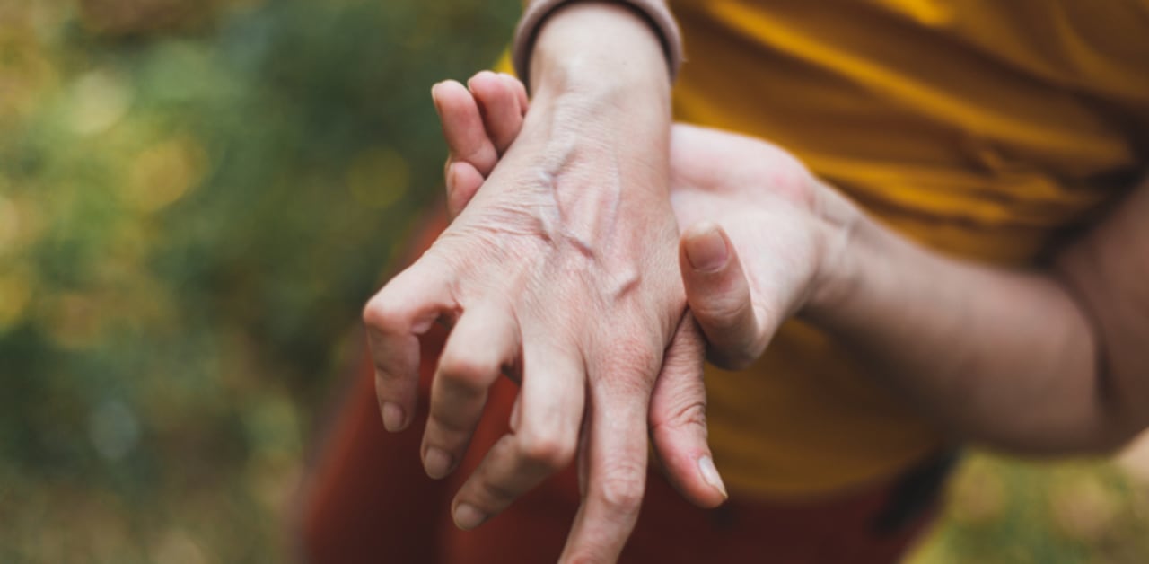 EULAR Develops Classification Criteria for Hand OA | Conexiant
