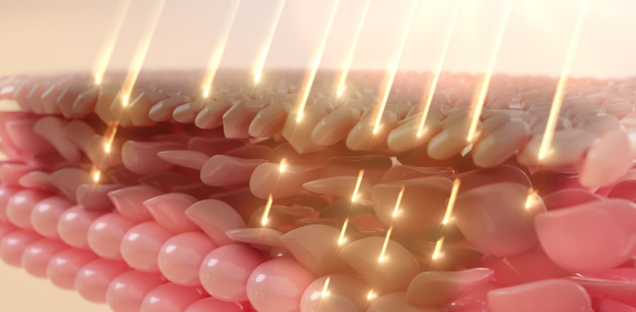 UVB and Psoriasis: More Than Immunosuppression | Conexiant