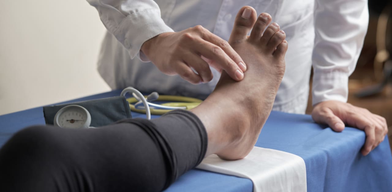Bioabsorbable Implants May Reduce Symptoms in Flatfoot Surgery | Conexiant