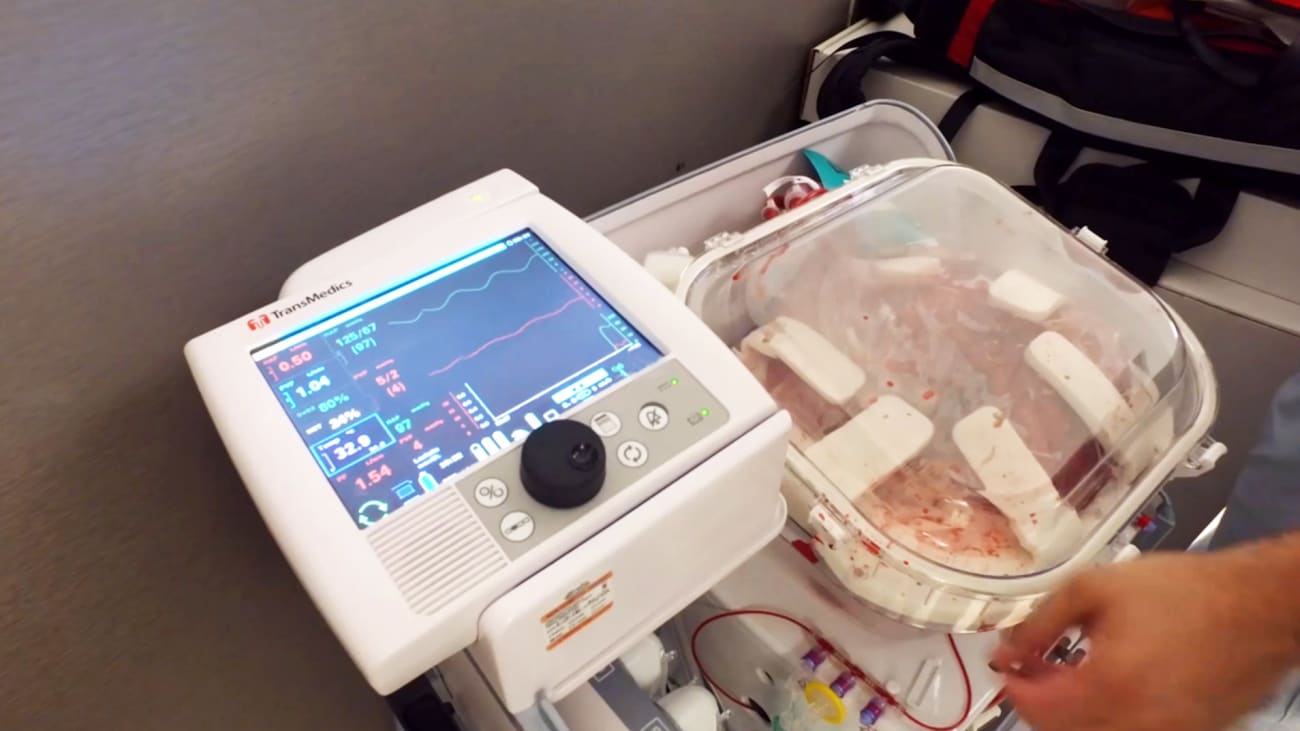 Liver Perfusion and Preservation - BroadcastMed