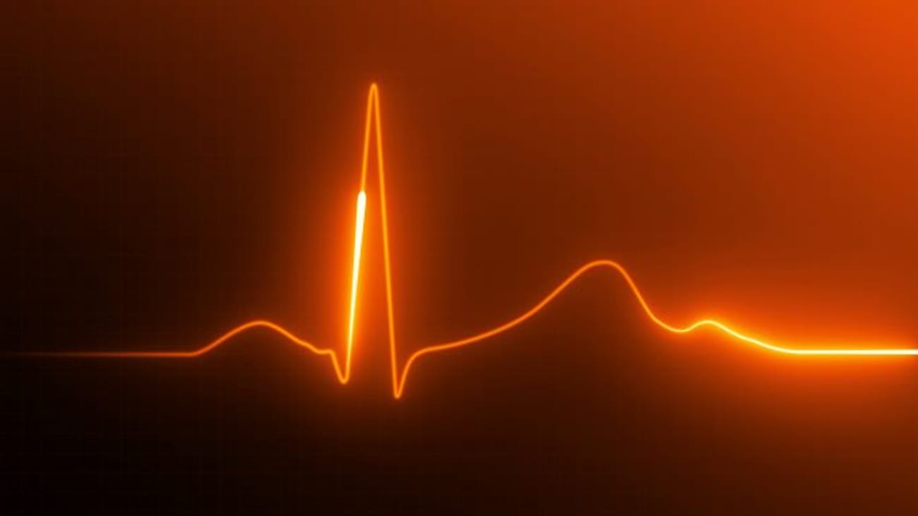 Inappropriate Sinus Tachycardia - IST, What is it? - Baptist Health ...