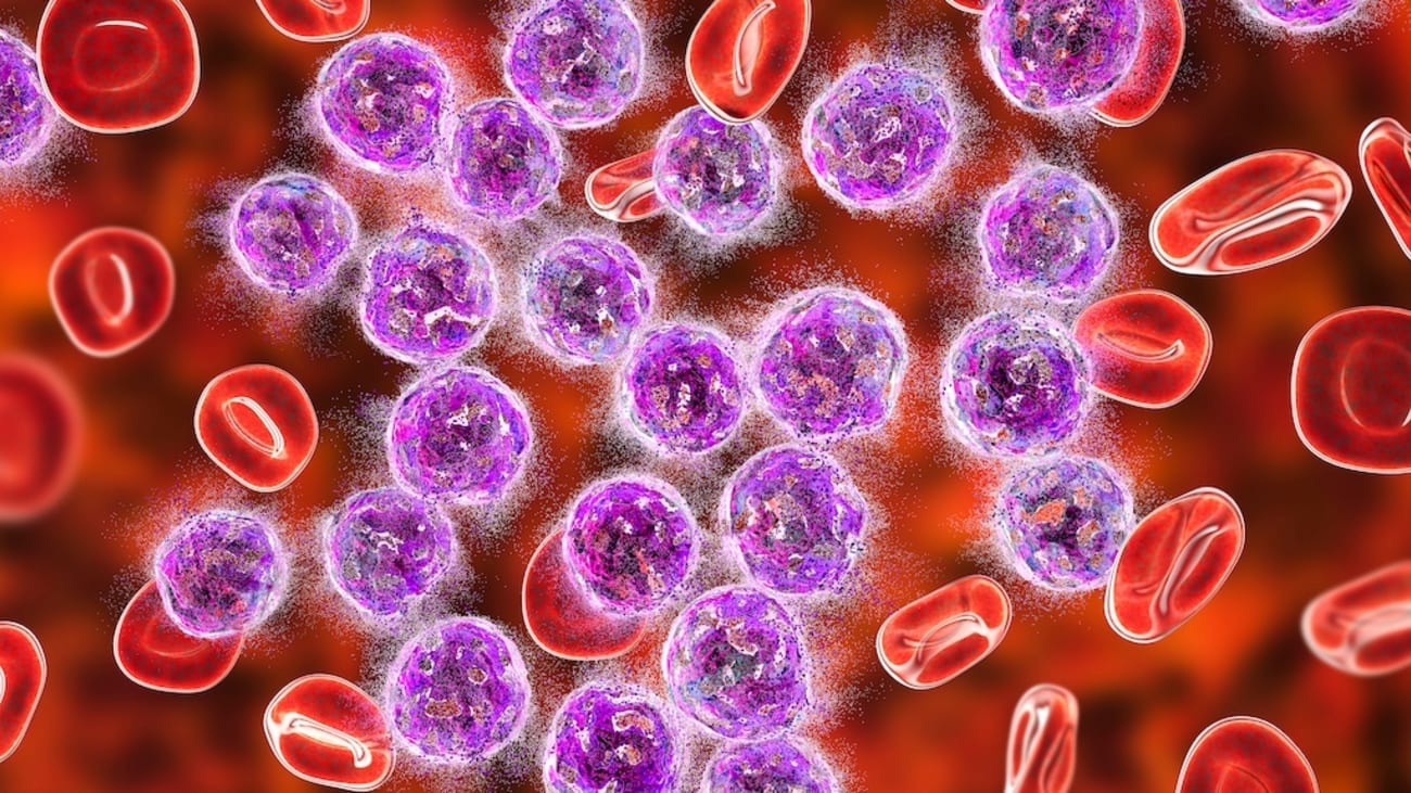 Join Us: Upstate New York Hematology & Hematologic Oncology Conference ...