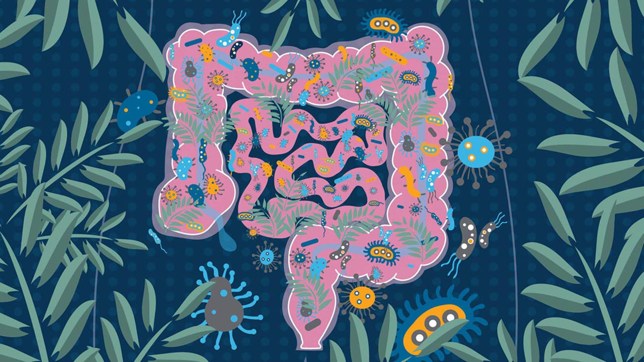 The Young-Onset Colorectal Cancer Center’s Gut Instincts Series - Dana ...