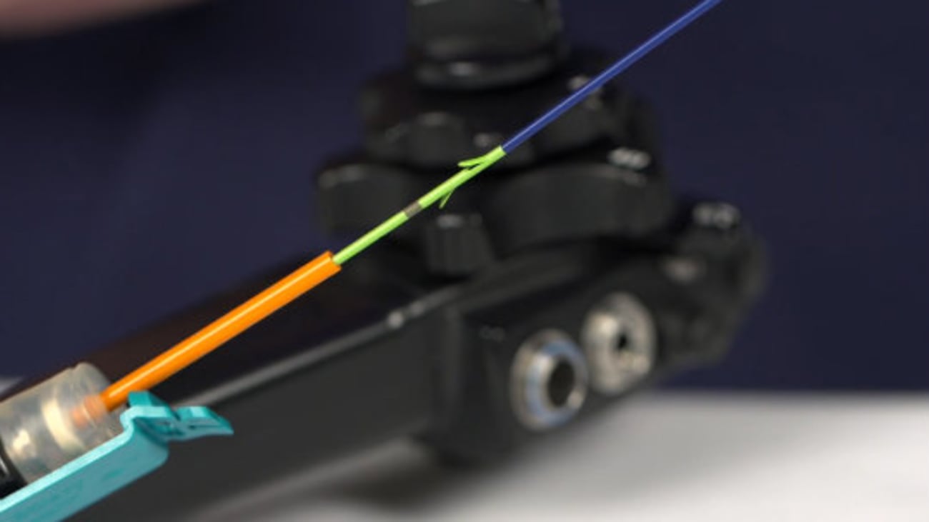 Video Tutorial: Advanix™ Pancreatic Stent Device Placement - Long Wire ...