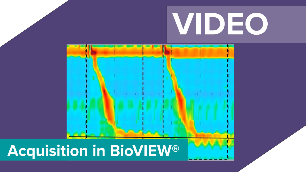 Acquisition of Esophageal Manometry Study using an HRiM Small Diameter ...