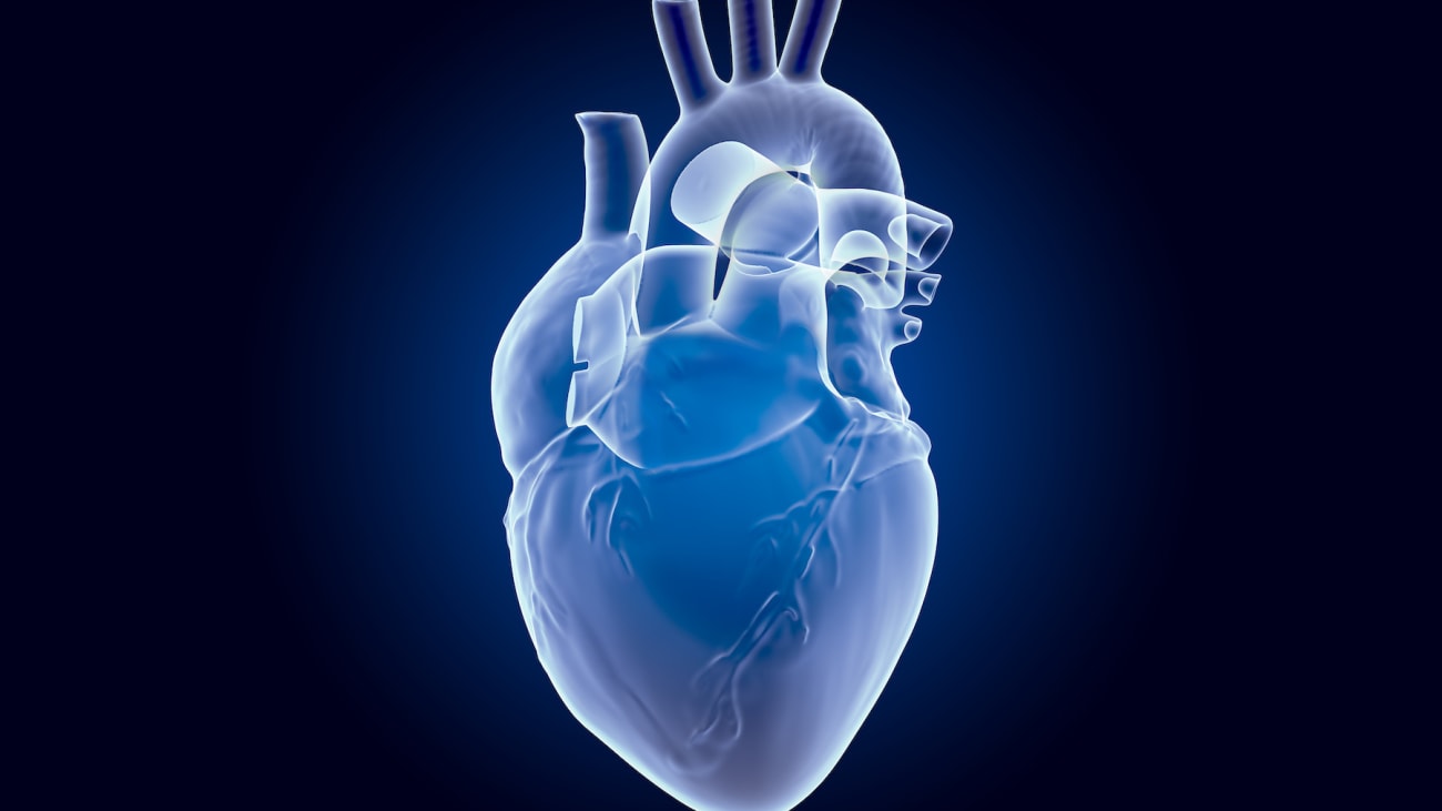 Management Of VT Storm - Sentara