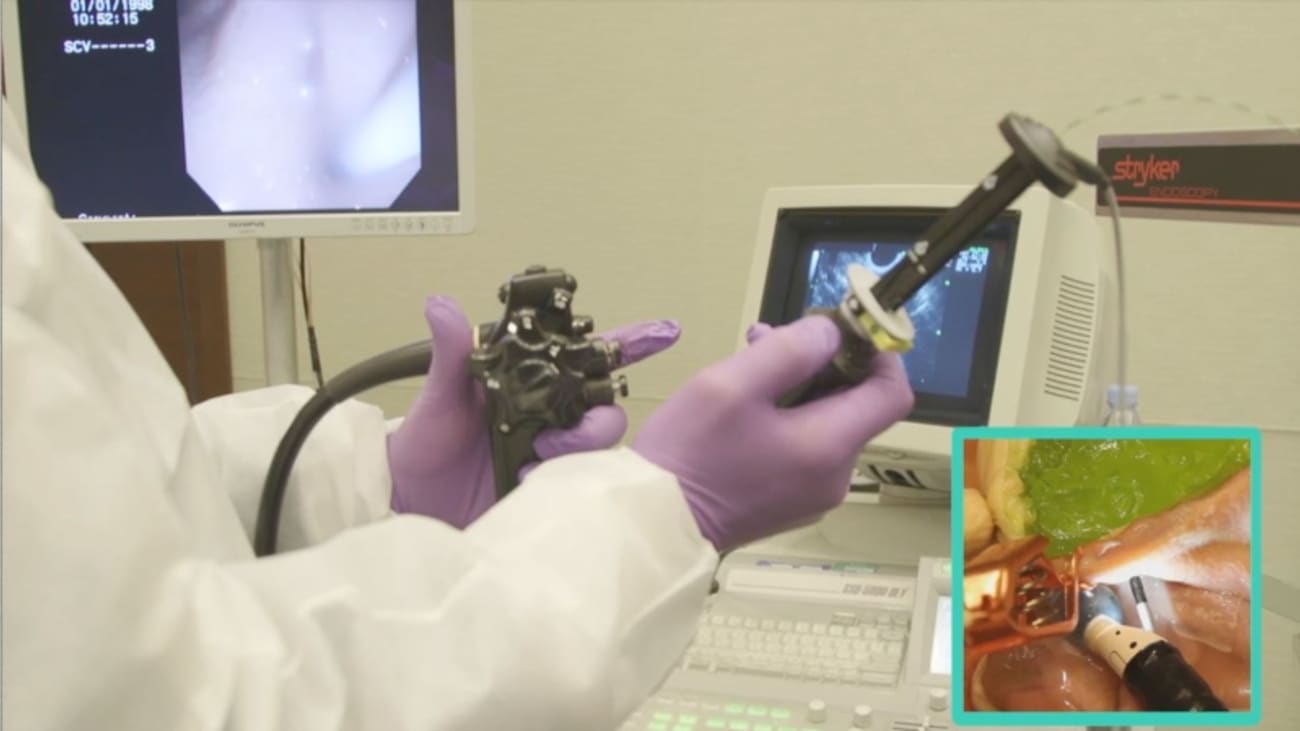 Set-up and Overview Video, by Todd Baron, MD - Boston Scientific GI Fellows