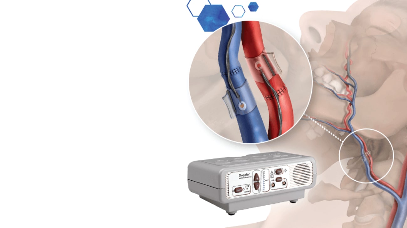 BEYOND THE PULSE: Techniques and Case Insights with the Implantable ...
