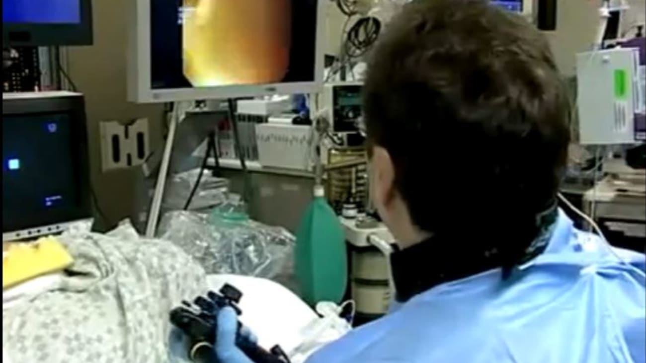 Patient Selection for Duodenal Stents, by Irving Waxman, MD & Kevin ...