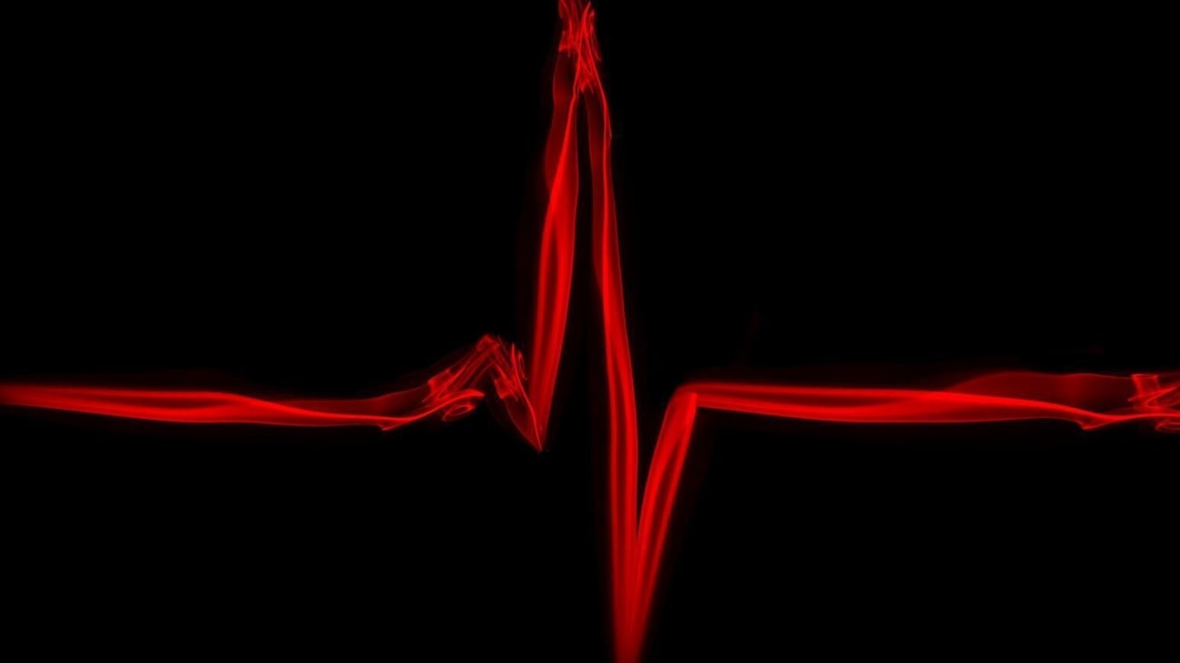 Mayo Clinic ventricular tachycardia calculator - Mayo Clinic