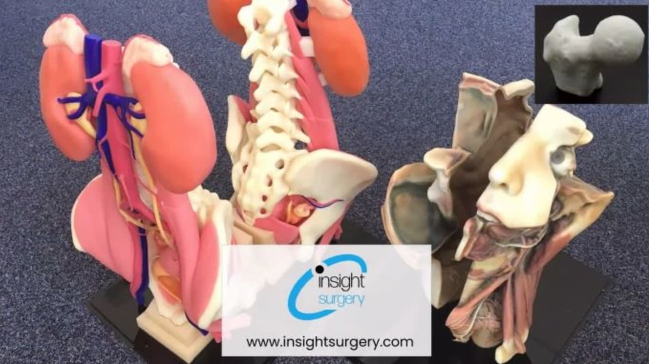 Innovation on the Loose: Insight Surgery, Personalized Surgical ...