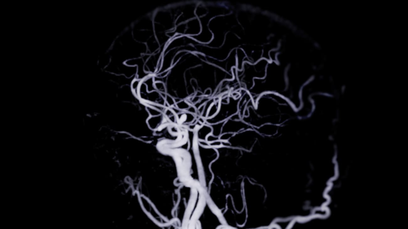 Charles G. Drake Cerebrovascular Lectureship - Baptist Health South Florida