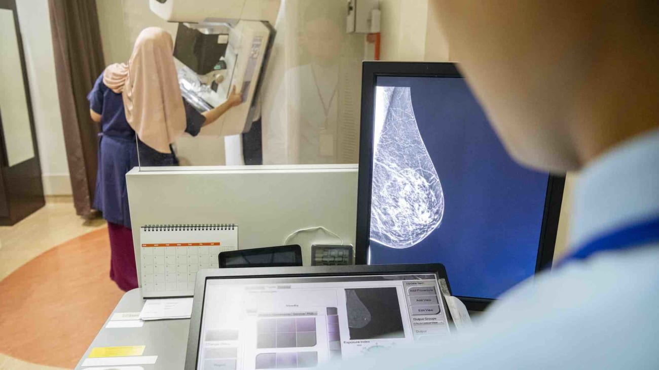 Screening Mammography Guidelines - BroadcastMed
