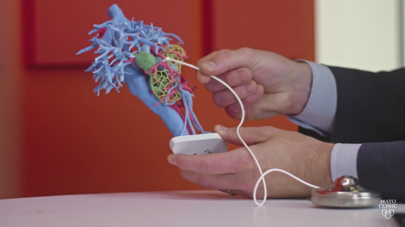 Hepatic artery infusion pump chemotherapy: Surgical treatment for ...