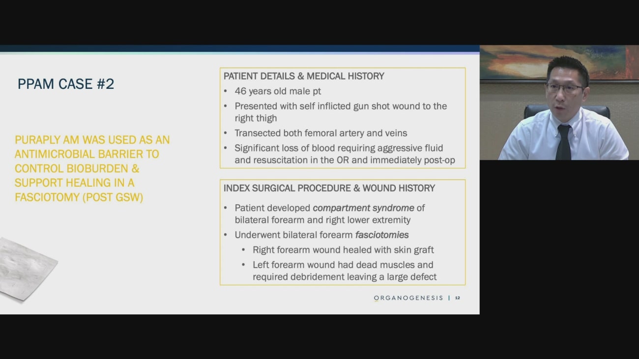 Fasciotomy Case Review with Dr. Charlie Cheng - Organogenesis