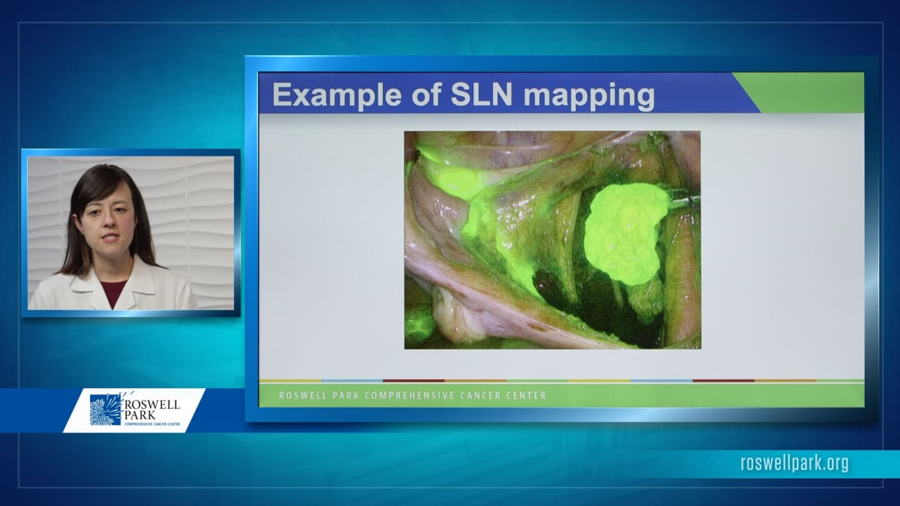 Sentinel Lymph Node Mapping in Endometrial Cancer - Roswell Park ...