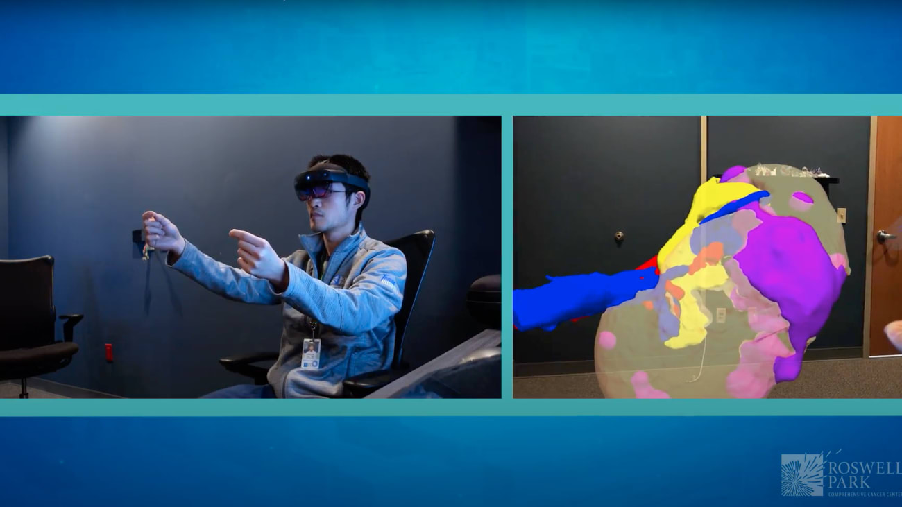 Using 3D Technology to Improve Patient Care - Roswell Park ...
