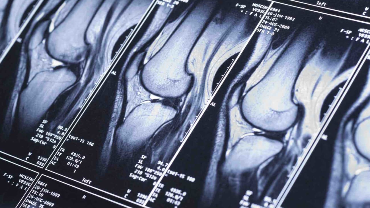 Part IV - Emergence of the IDTF and the Impact on Image Ordering - Sentara