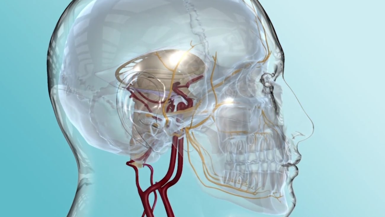 Trigeminal Neuralgia Symptoms and Treatment Options - UCSF MedConnection