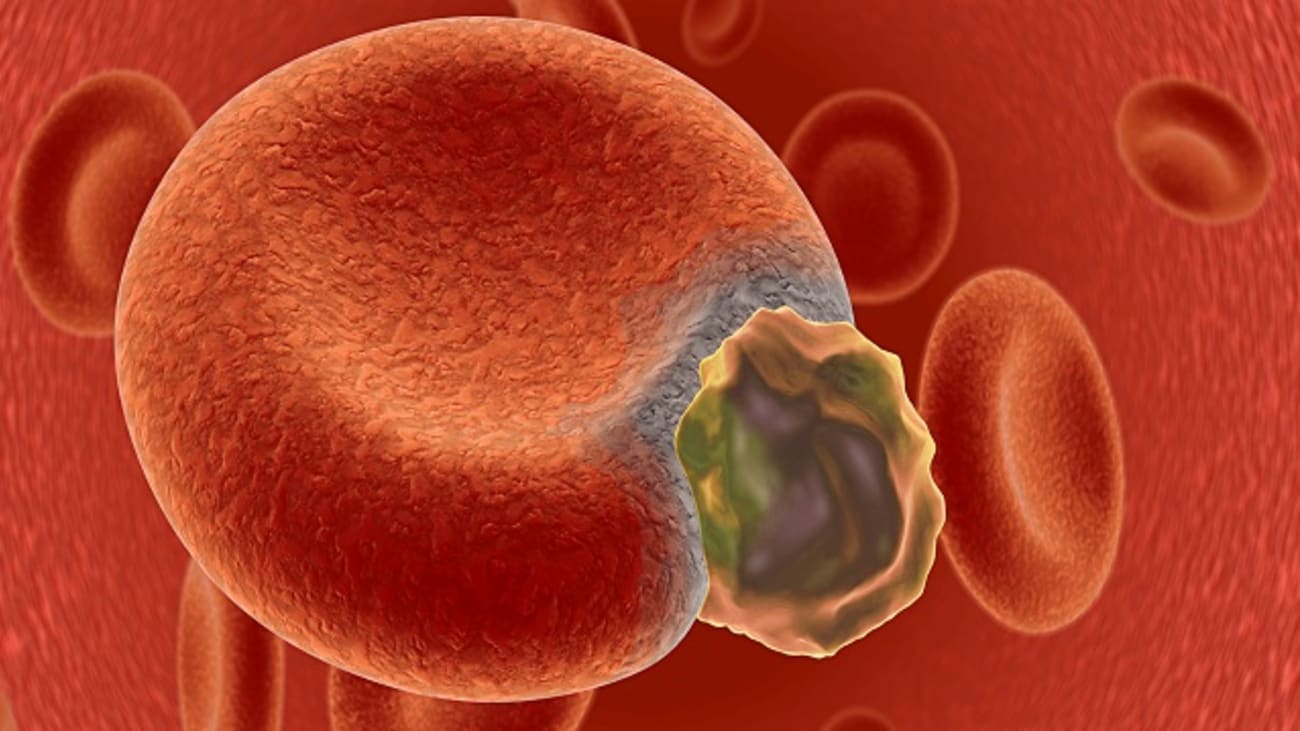 Sepsis and Septic Shock - St. David's HealthCast