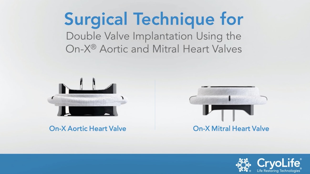 Surgical Technique for Double Valve Implantation Using the On-X® Aortic ...