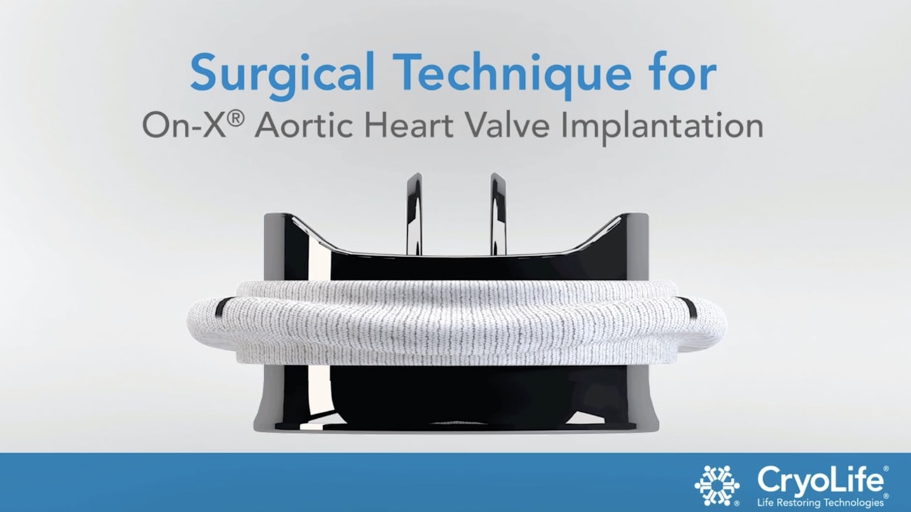 Surgical Technique for On-X® Aortic Heart Valve Implantation - Artivion