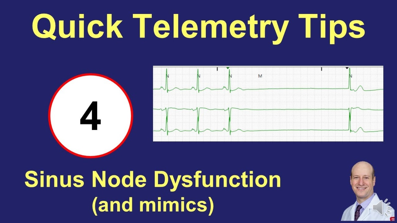 Telemetry Tips Part 4: Sinus Node Dysfunction - Temple Health