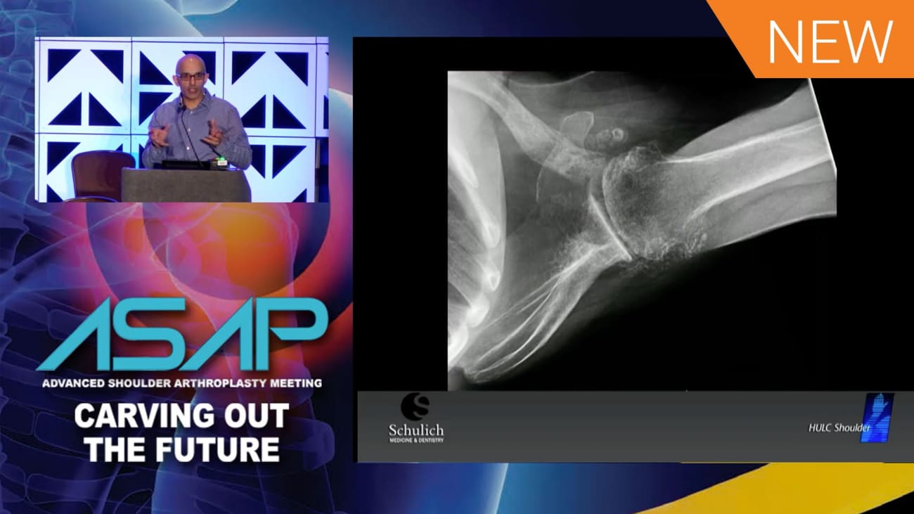 Bio RSA - Dr. Athwal - ASAP Meeting 2020 [AP-013791-A] - BroadcastMed