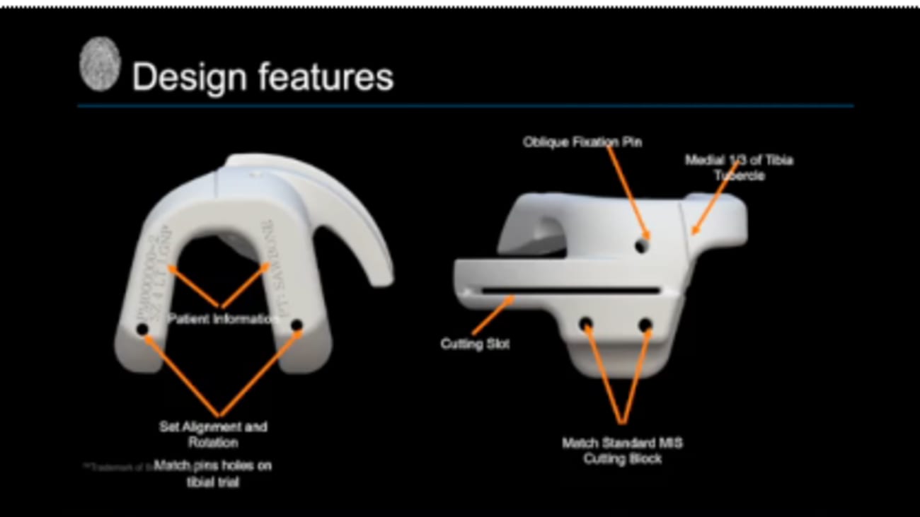 VISIONAIRE™ Technology - Design Features - Smith & Nephew