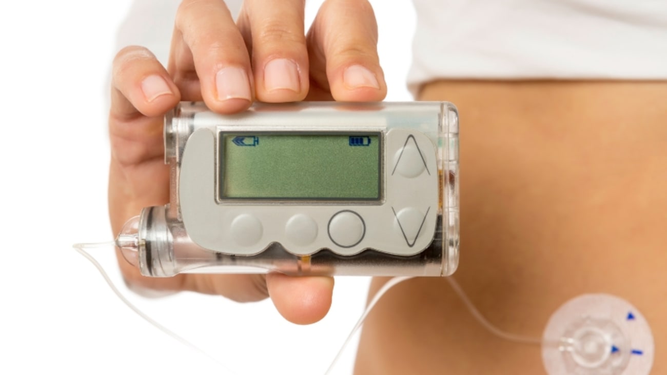 Practical Approaches to Insulin Pumps - BroadcastMed