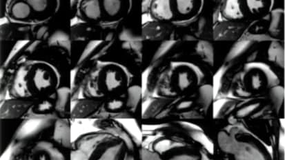 Cardiac Mri Basic Principles Houston Methodist Hospital